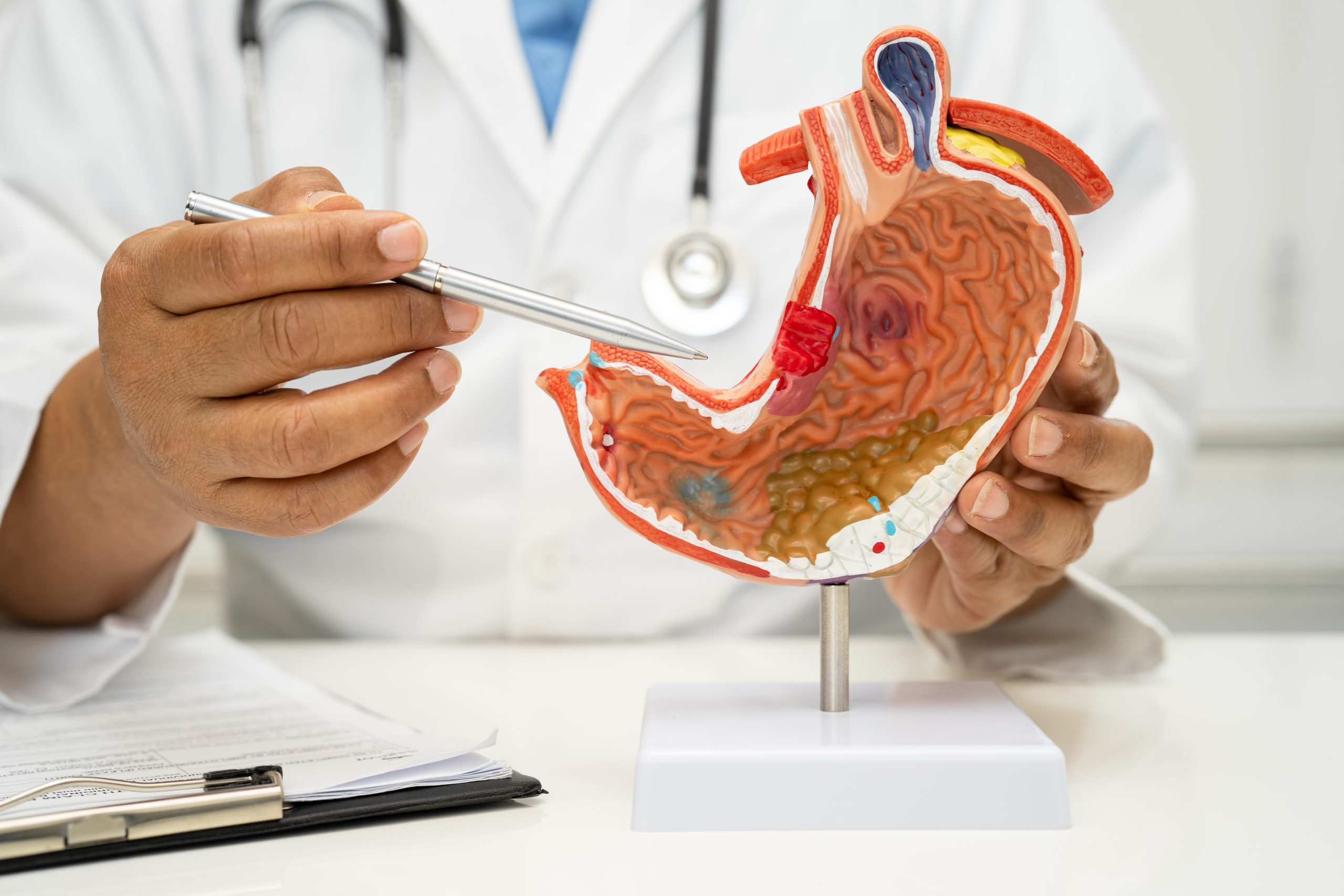 Bypass gástrico: qué es y cómo mejora tu calidad de vida - Instituto MediQ